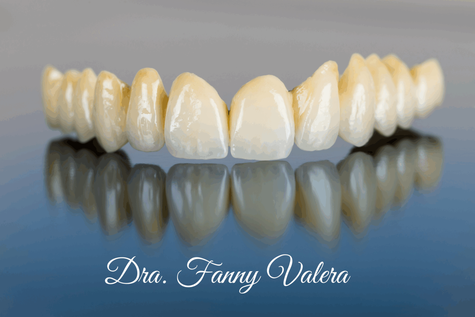 Dental Bridge Solutions for a Perfect Smile - Smile Makeover Cartagena ...
