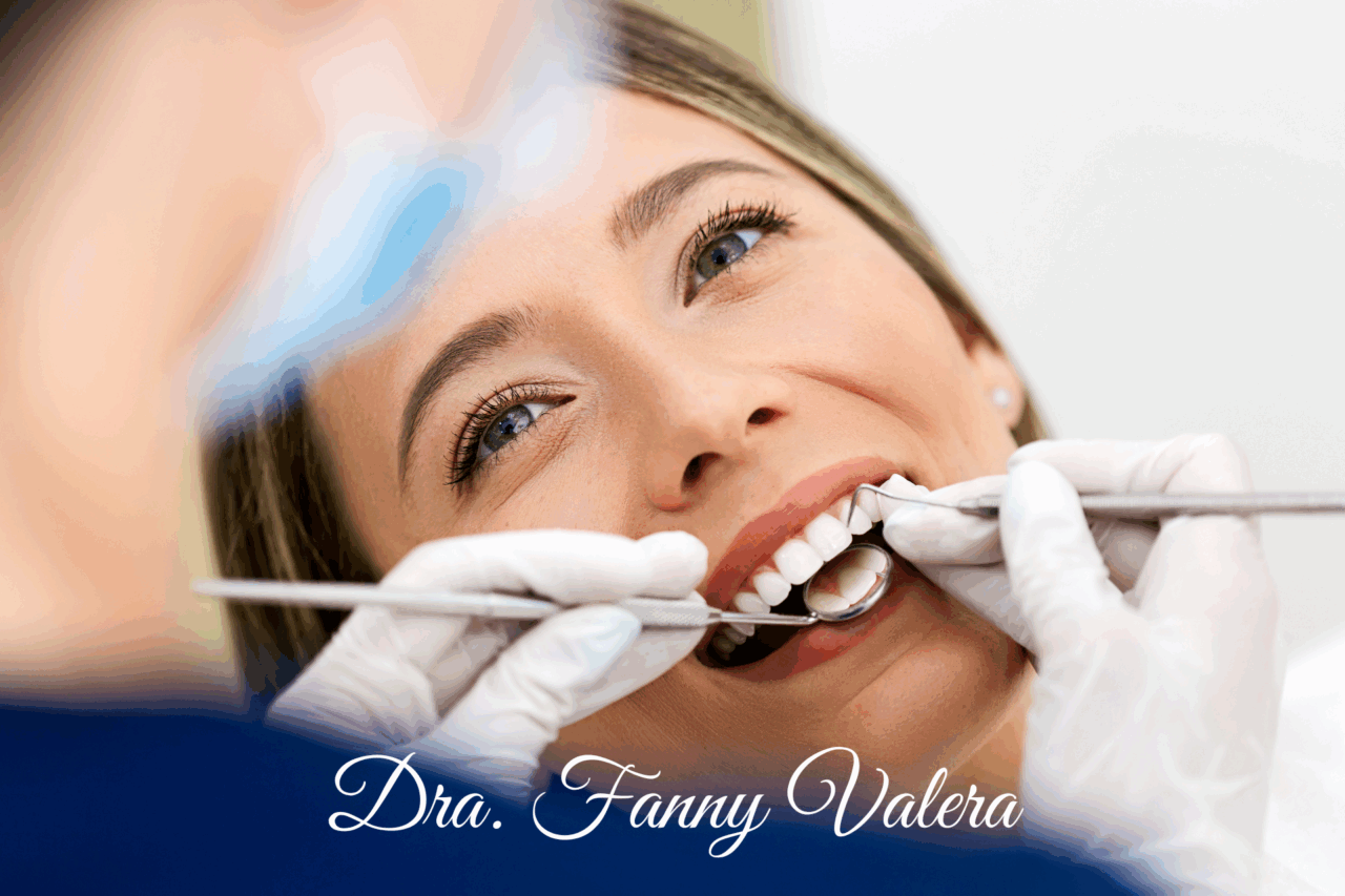 Package Porcelain Veneers - Smile Makeover Cartagena Dental Clinic by ...